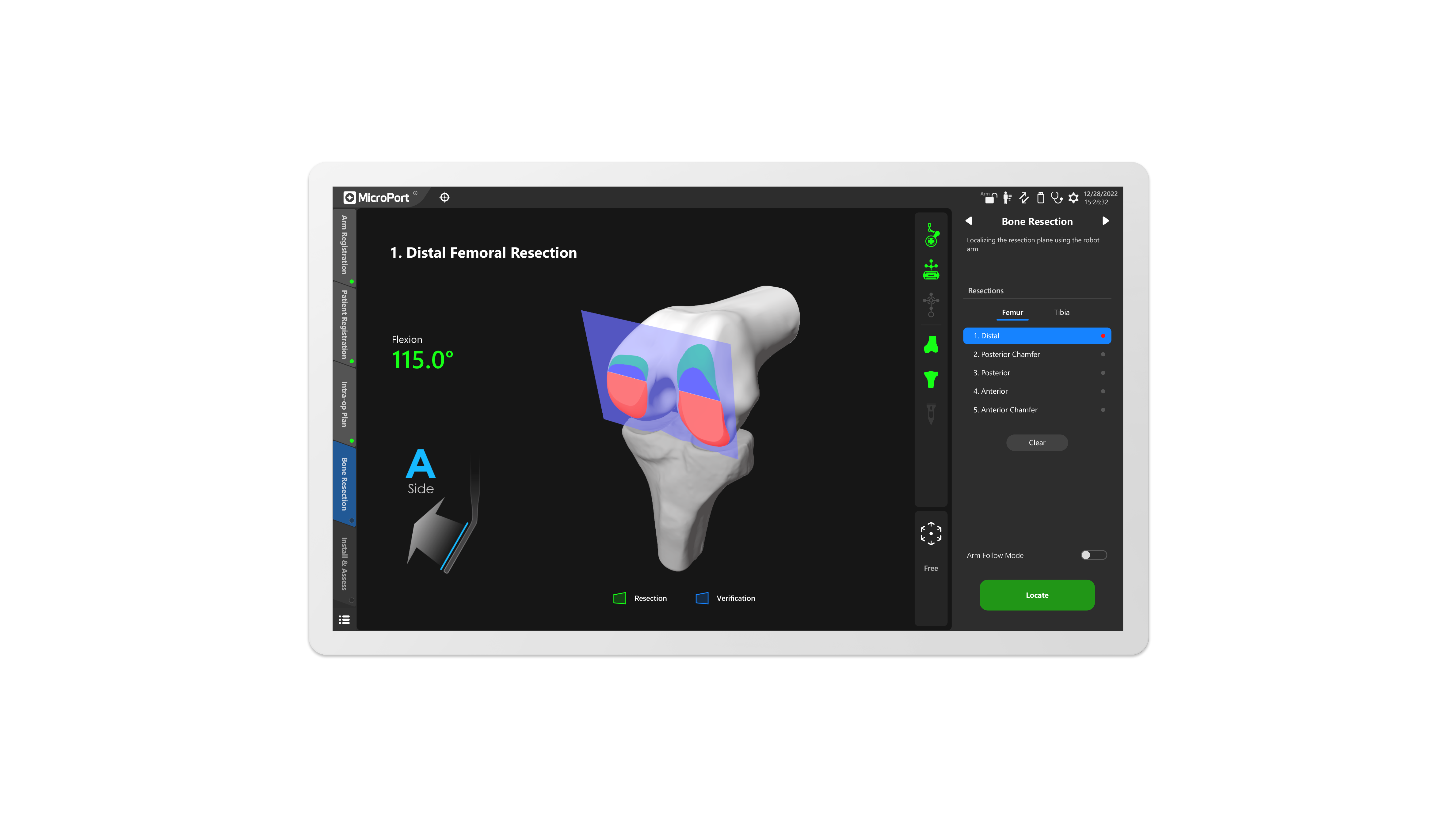 iF Design - Honghu Robotic Orthopedic Surgical System